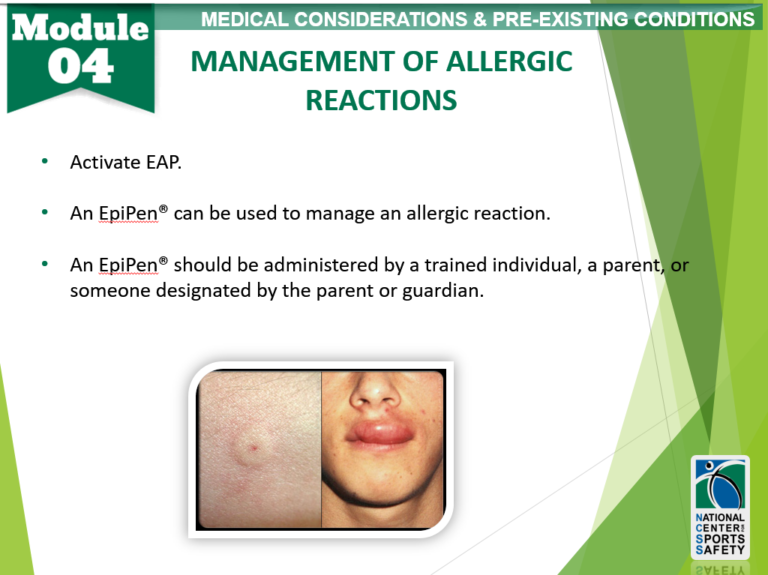13-management-of-allergic-reactions – National Center for Sports Safety